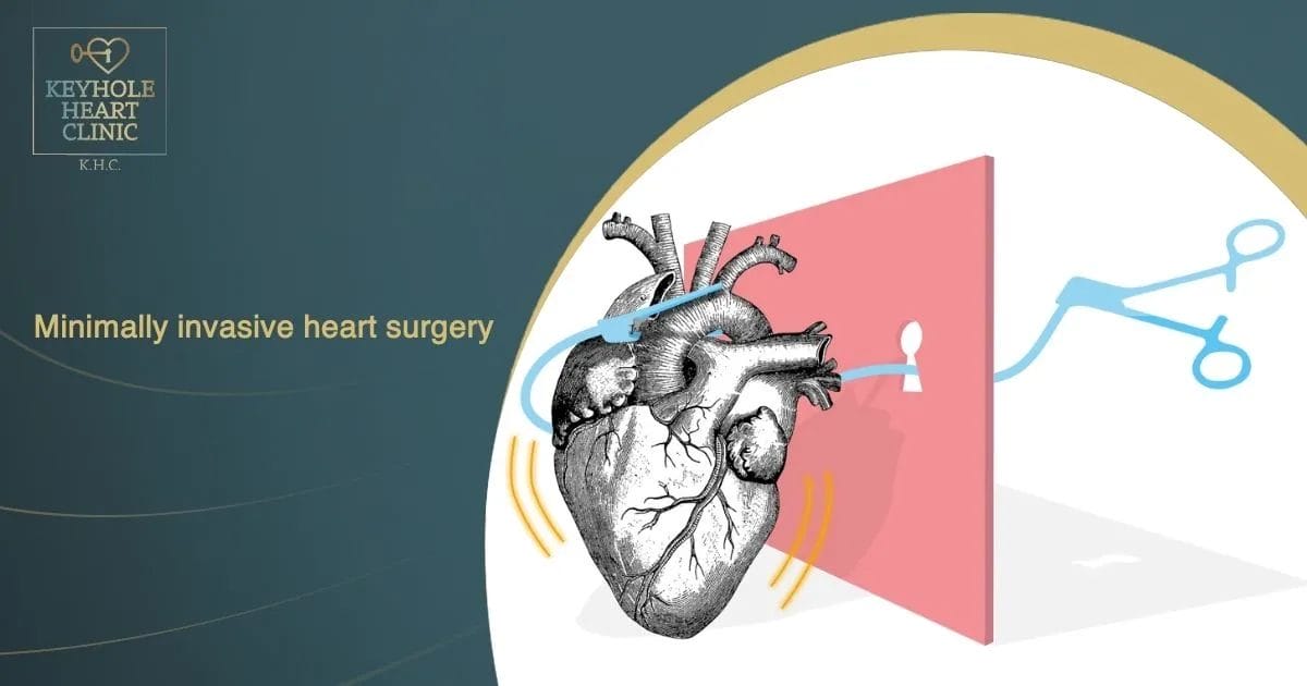 Minimally invasive heart surgery | Dr. Muhammad Al-Ghannam