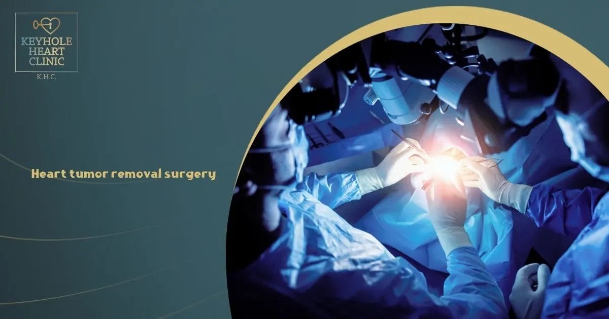 Heart tumor removal surgery | Dr. Muhammad Al-Ghannam